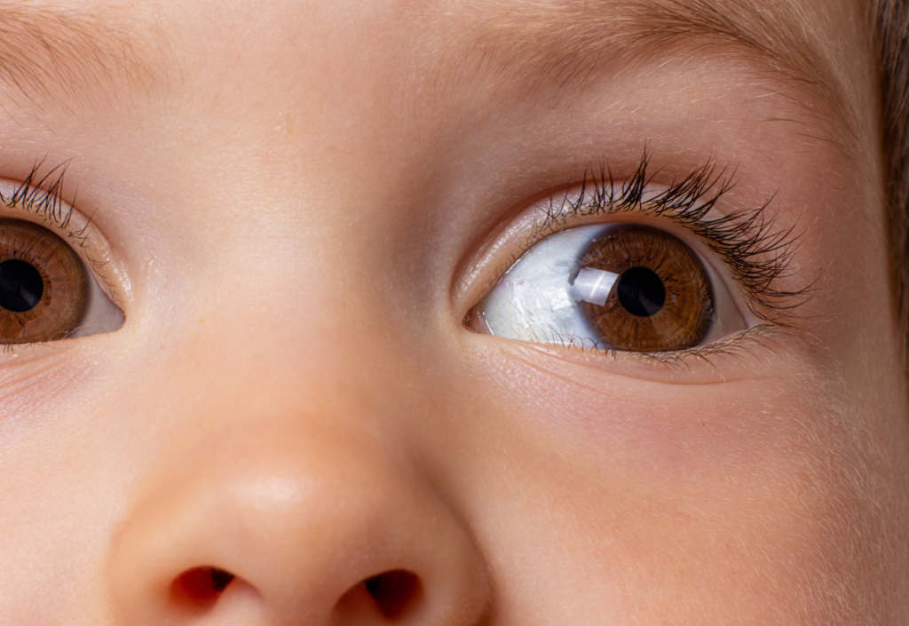 Future design of special schools eye care service being consulted on ...